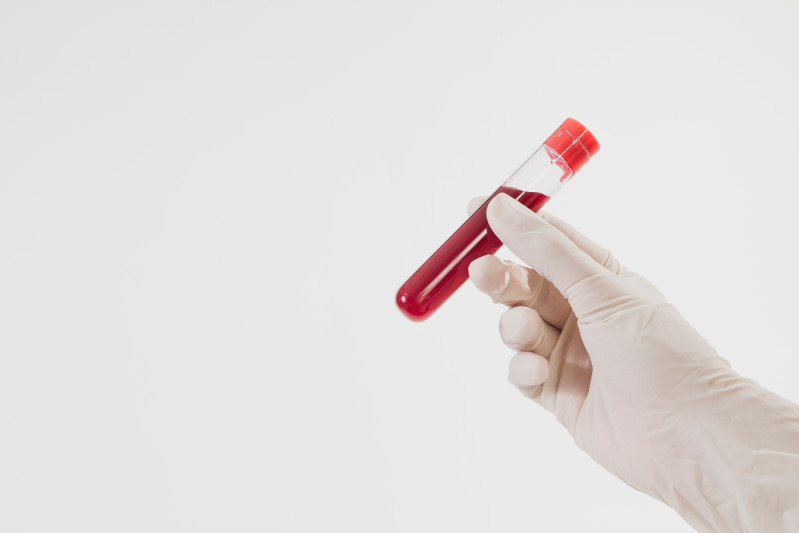 Apa itu Albumin? Ini Pengertian, Fungsi, dan Kadar Normalnya